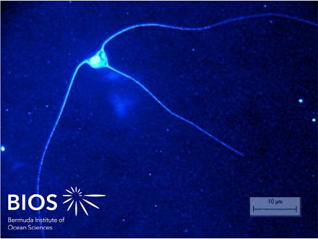 Plankton Profile: Ceratium | BIOS