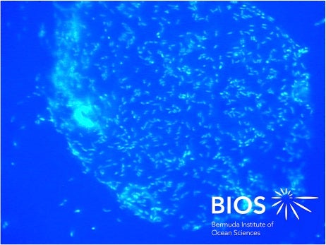 Plankton Profile: Oil Bacteria | BIOS